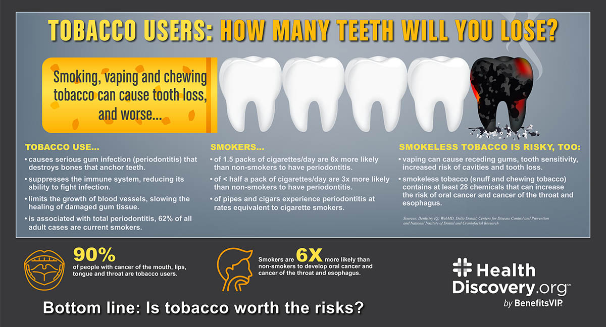 INFOGRAPHIC: How Many Teeth Will You Lose?